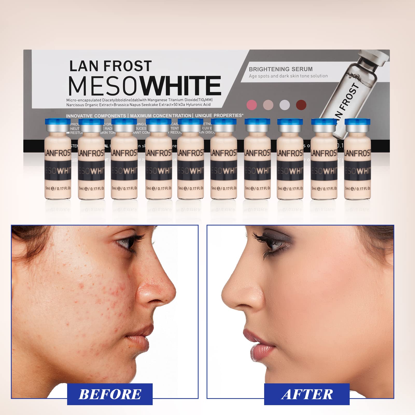 ZOETOOL bb serm Pigment bb serm Starter Kit Skin Care Treatment 10 Vials Anti Aging Serum Moisturing Essence Foundation bb serm Natural Color
