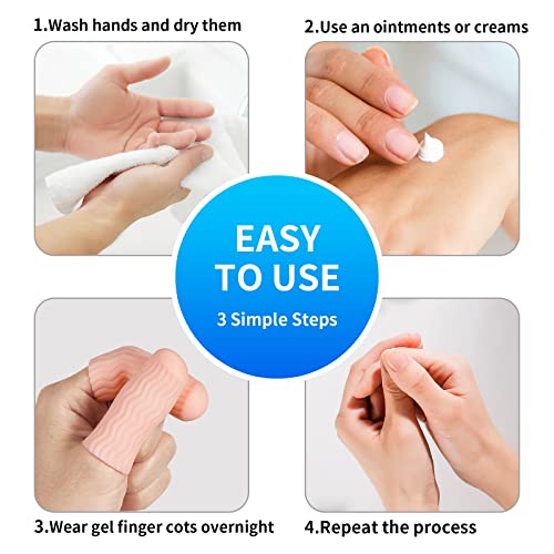 tifanso 12 PCS Finger Cots - Finger Protectors Gel Finger Gloves Covers Fingertip Sleeves Guards for Cracked Skin, Trigger Finger and More, Large Size