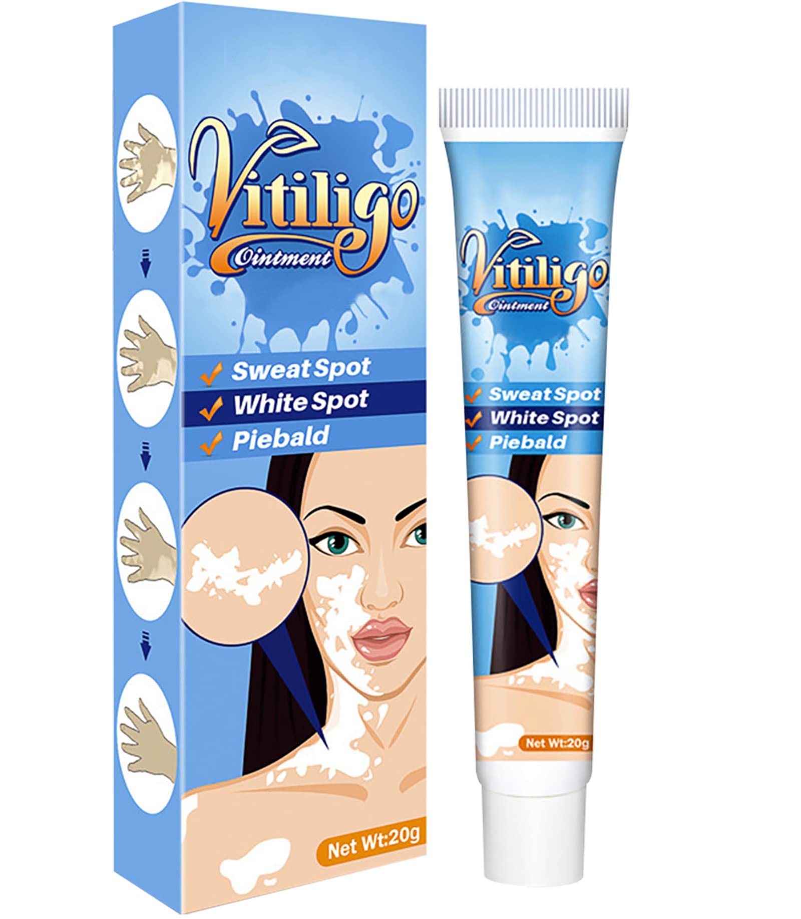 Xshows Vitiligo Cream, Vitiligo Treatment for Reduce White Spots and Improve Skin Pigmentation (Packaging May Vary)