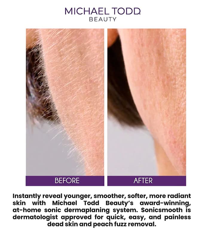 Michael Todd Beauty - Sonicsmooth Replacement Kit for At-Home Dermaplaning - 7 Replacement Safety Edges Only