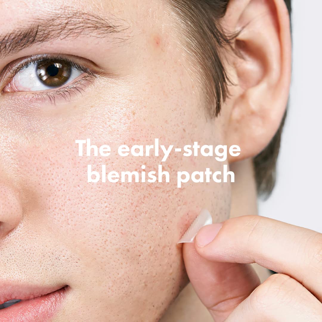 Mighty Patch Micropoint for Blemishes from Hero Cosmetics - Hydrocolloid Acne Spot Treatment Patch for Early Stage Zits and Hidden Pimples, 395 Proprietary Micropoints (6 Patches)