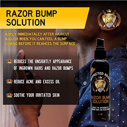 Natural Razor Bump Solution for Men - Serum that Reduces Ingrown Hairs - Aftershave Serum for Dry Skin - Beard Growth Moisturizer & Spray by Respected Roots