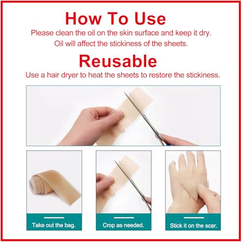 Silicone Scar Sheets (1.6β x 120β Roll-3M), Silicone Scar Tape Roll, Scar Silicone Strips, Reusable, Professional Scar Removal Sheets for C-Section, Surgery, Burn, Keloid, Acne et