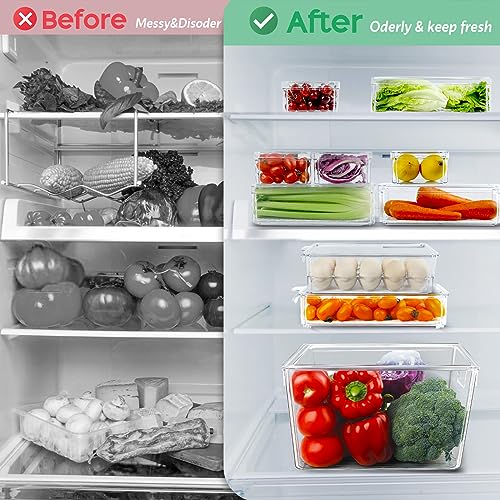 Ozera 12Pcs Refrigerator Organizer Bins, Fridge Organizer with Egg Holder, Stackable Fruit Storage Containers for Fridge, BPA-free Clear Fridge Organizers and Storage with Lids for Vegetables