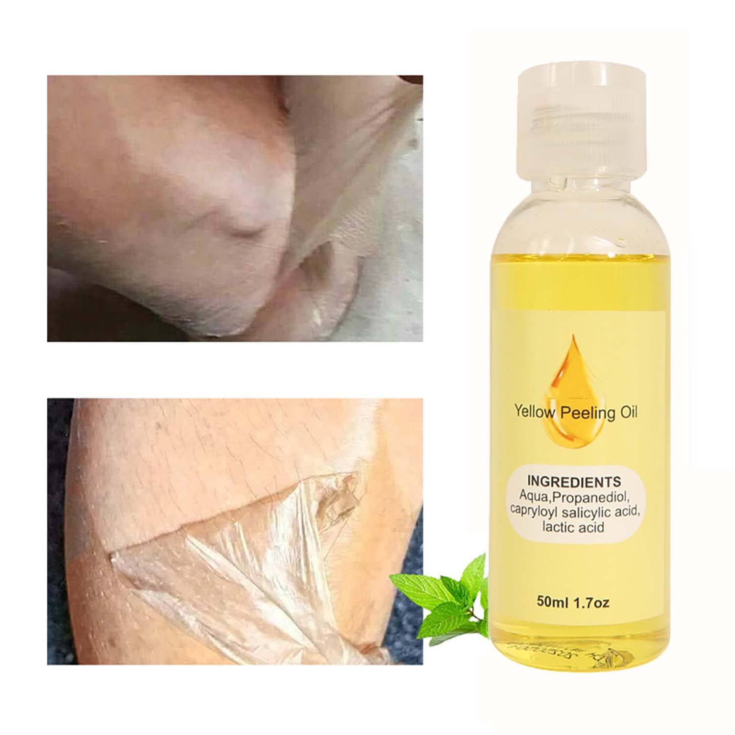 Natural Spots Whitening Yellow Peeling Oil 50ml, 1.7oz, Super Strength Yellow Peeling Oil Exfoliating for Dark Skin, Peeling Solution Bleaching Lighten Elbows Knees Hands Melanin (50ml*1pc)