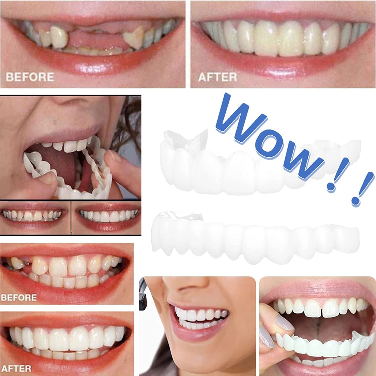 Upper and Lower Veneer, Dentures for Women and Men, Fake Teeth, Natural Shade! Fix Your Smile at Home Within Minutes!