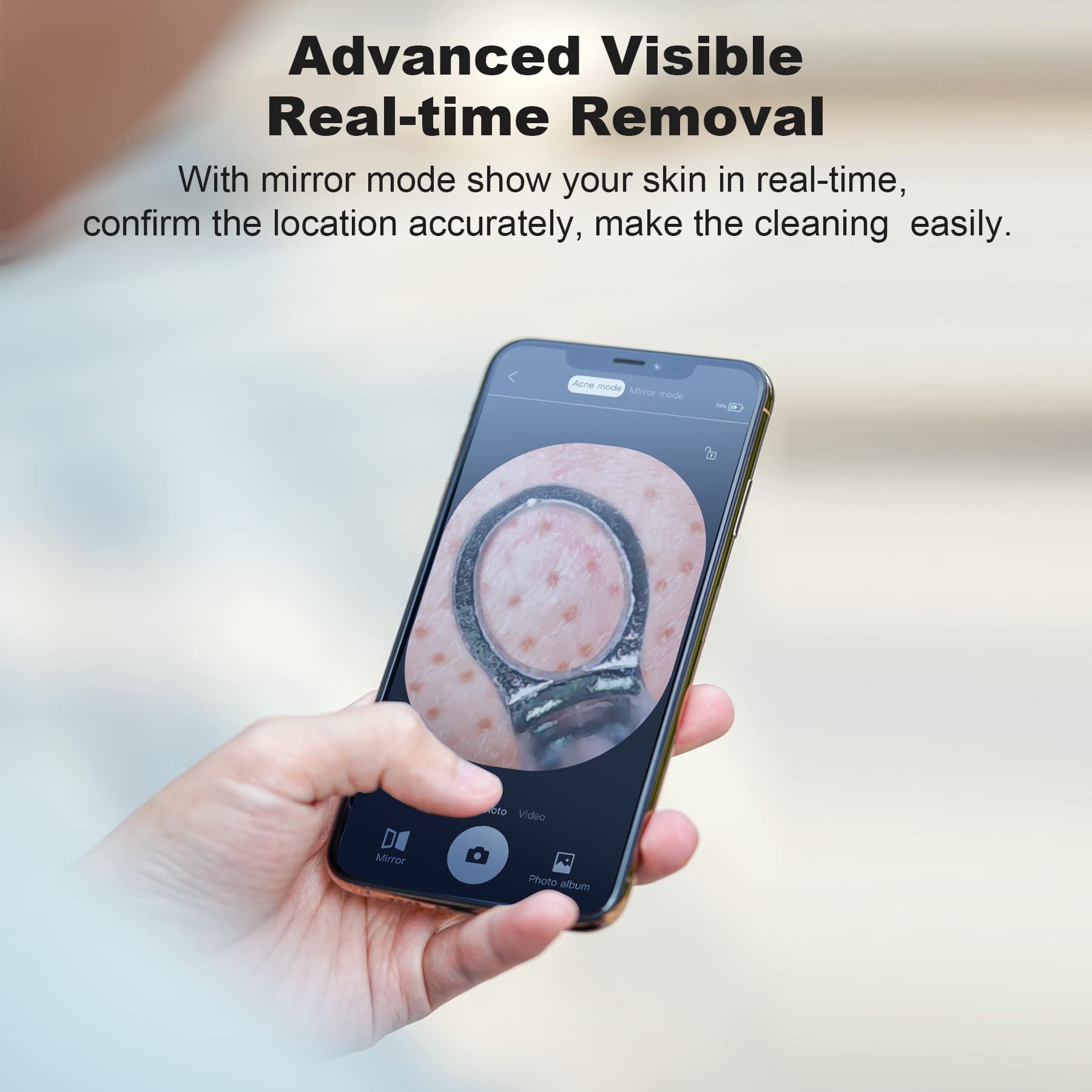 YUYUKO Blackhead Remover Tools, Pimple Popper Tool Kit, Visible Pore Cleaner with Ultra HD Camera and Lights, Rechargeable, Comedones Blackhead Extractor Tool for iPhone, iPad & Android Smart Phones