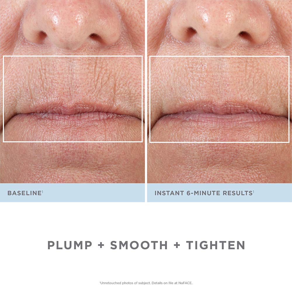 NuFACE FIX | Line Smoothing Device | Targeted Microcurrent Treatment | Mascara-sized Skin Care Device to Instantly Firm, Smooth, and Tighten | Break The Ice Collection, 1 ct.