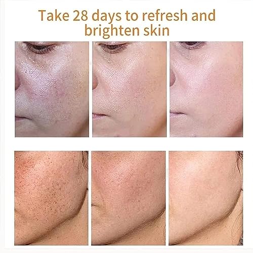 MAPUG Dr Hancy White Spot Cream China,Skin Care Facial Moisturizer Face Cream,Dark Spot Corrector for Face,For Dry & Sensitive Skin (3PCS)