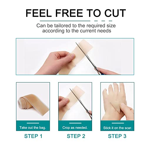 Silicone Scar Sheets (1.6β x 120β Roll-3M), Silicone Scar Tape Roll, Scar Silicone Strips, Reusable, Professional Scar Removal Sheets for C-Section, Surgery, Burn, Keloid, Acne et
