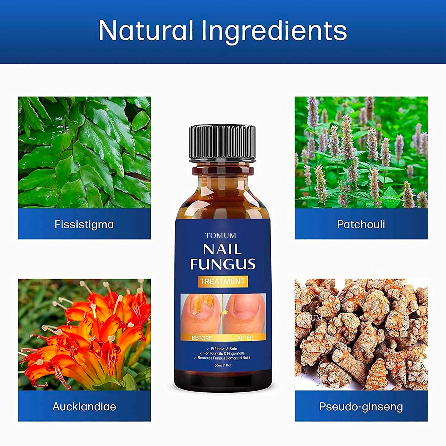 Nail Fungus Treatment for Toenail, Extra Strength Effective Fingernail and Toenail Fungus Killer,Nail Repair Solution, Restoring Healthy Nails