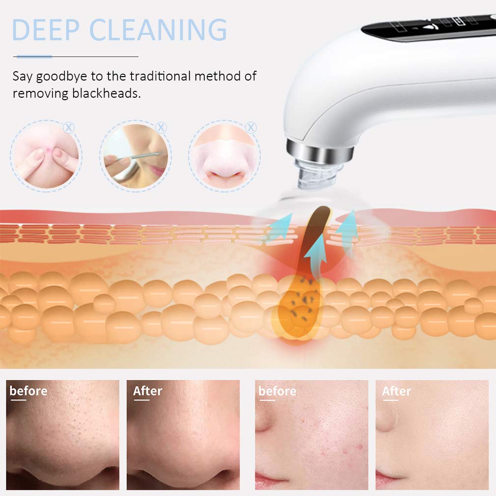 Pahajim Blackhead Remover Pore Vacuum - Electric Blackhead Vacuum Cleaner Blackhead Extractor Tool Device Comedo Removal Suction Beauty Device (White)