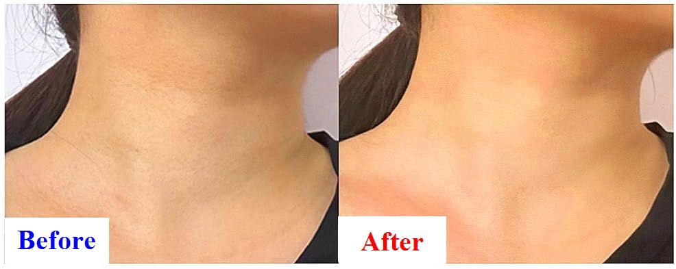 WHITESILK―(𝟐𝟎𝟐𝟒 𝐔𝐩𝐠𝐫𝐚𝐝𝐞𝐝) [(0.03%) Retinaldehyde +(1%) Bakuchiol] INSTANT Wrinkle Smoothing & Line Filler Cream (30ml/1oz)