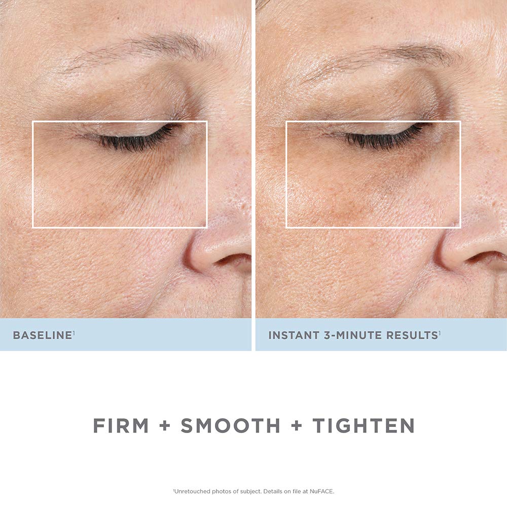 NuFACE FIX | Line Smoothing Device | Targeted Microcurrent Treatment | Mascara-sized Skin Care Device to Instantly Firm, Smooth, and Tighten | Break The Ice Collection, 1 ct.