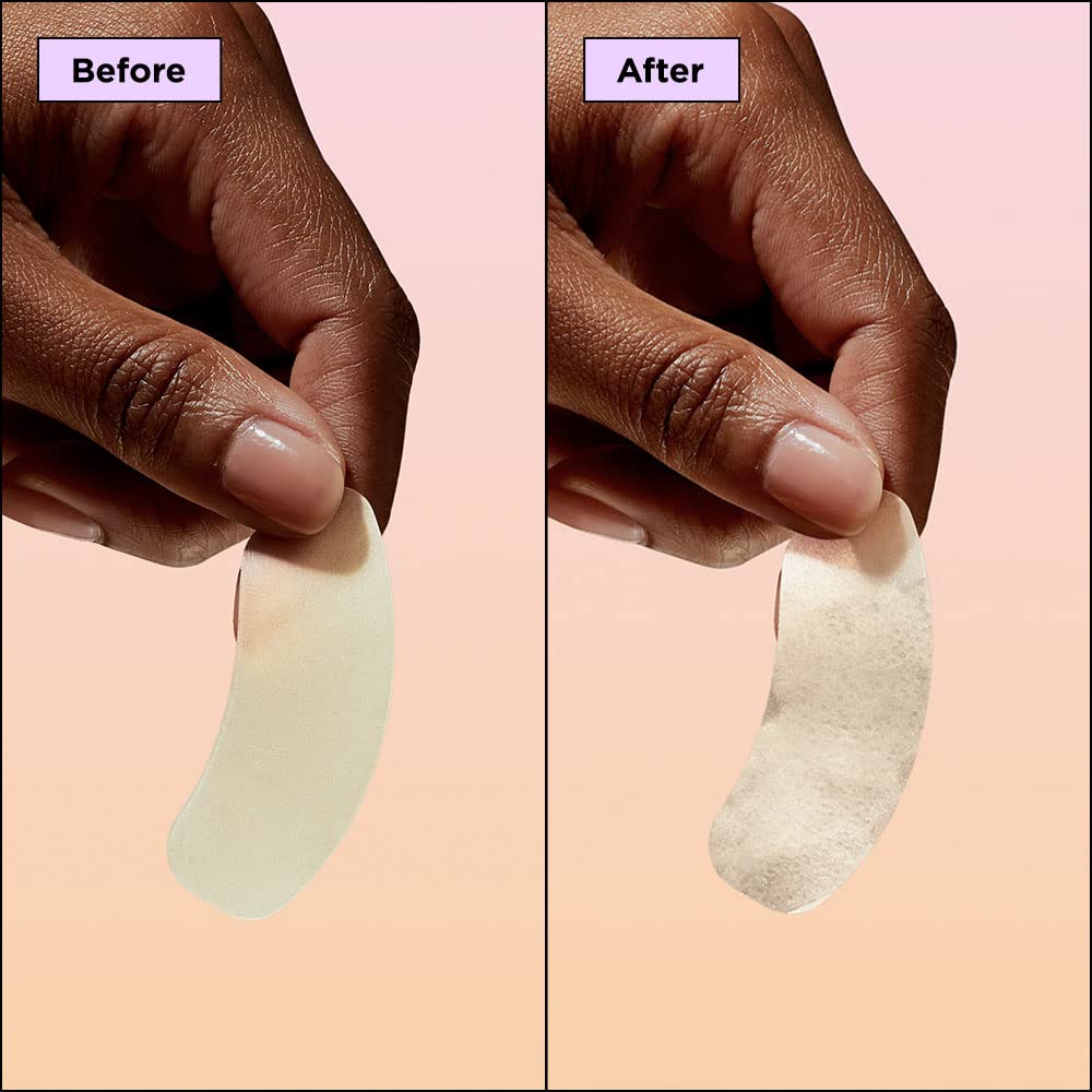 ZitSticka Hydrocolloid Surface Area Pimple Patches for Face - 2 Pack FACE MAP for Large Zit T-Zone Coverage - Absorbs Oil, Unclogs Pores, & Targets Clusters - Zit Patch and Sticker