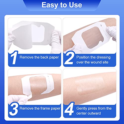 Niceful 10 Packs Calcium Alginate Dressing 4x4 in, 100 Packs Transparen Film Dressing 2.35x2.75 in, High Absorbent Alginate Dressign with Waterproof Barrier