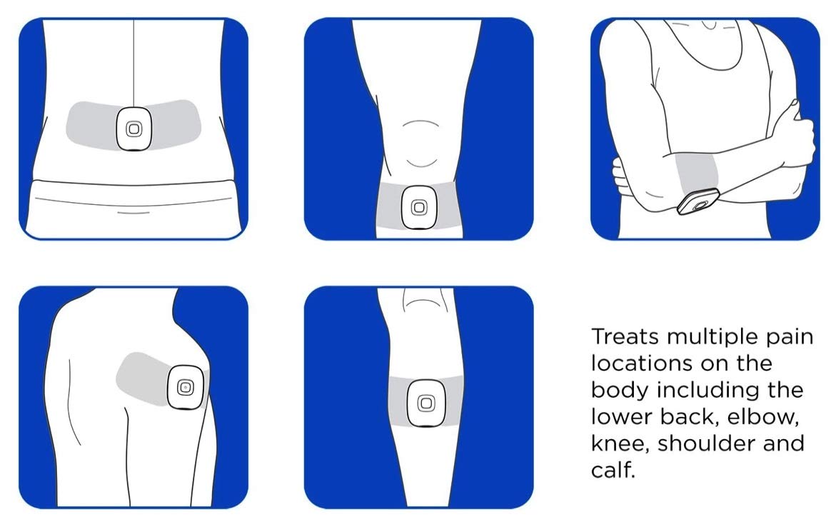 Omron Avail Medium Wireless Pad (Pmwpad-M) β Used with Avail Tens Unit (Pm601), 1.41 Ounce