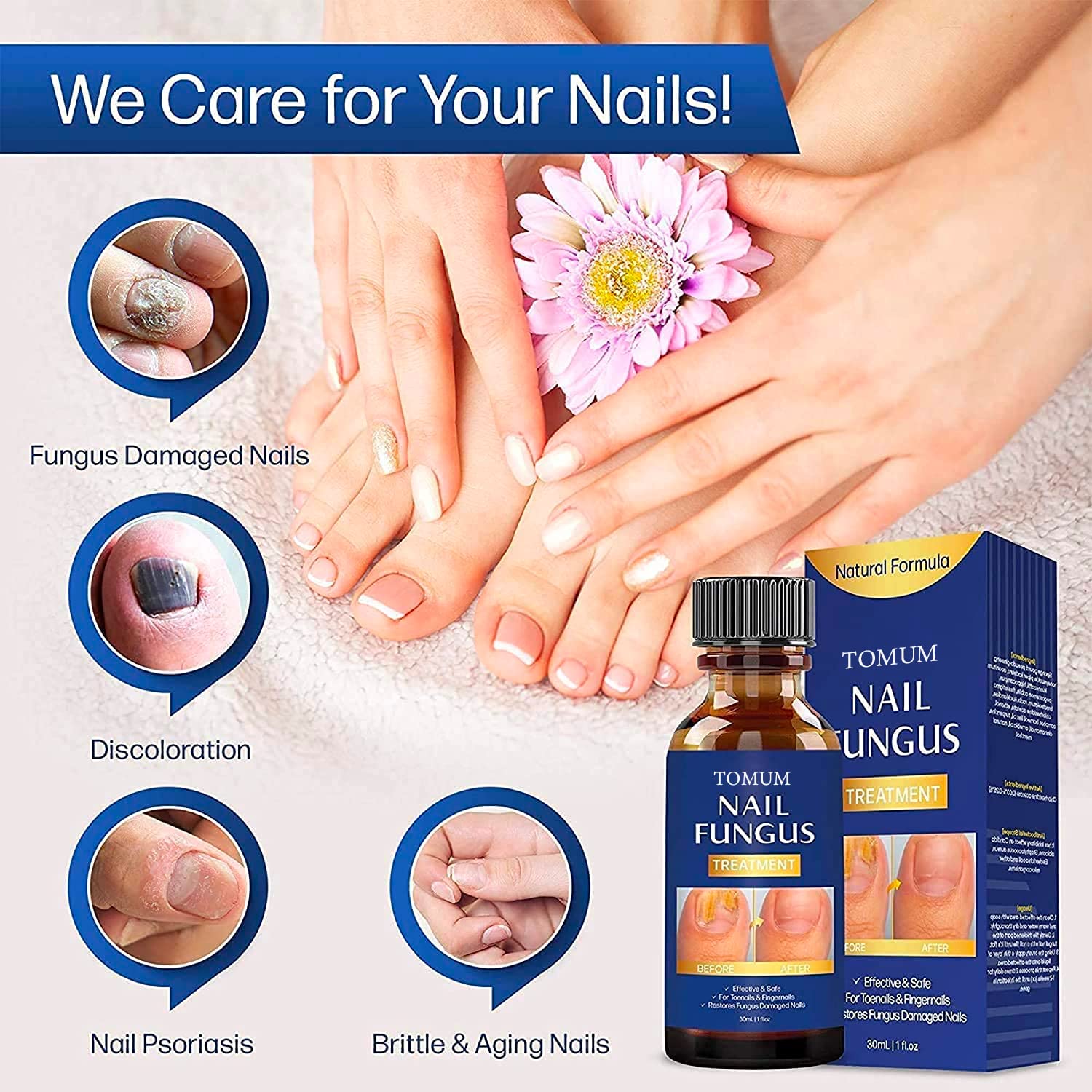 Nail Fungus Treatment for Toenail, Extra Strength Effective Fingernail and Toenail Fungus Killer,Nail Repair Solution, Restoring Healthy Nails