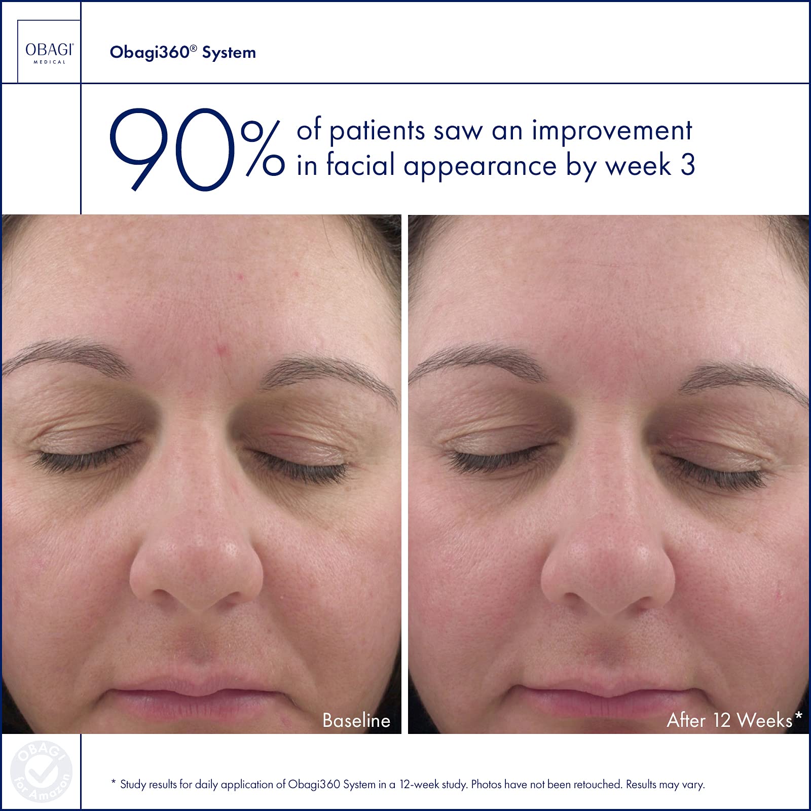 Obagi Medical 360 System, 3 Piece Kit. Includes: Exfoliating Face Cleanser, HydraFactor Broad Spectrum SPF 30 Sunscreen, Retinol Moisturizer Cream for Face. Pack of 1