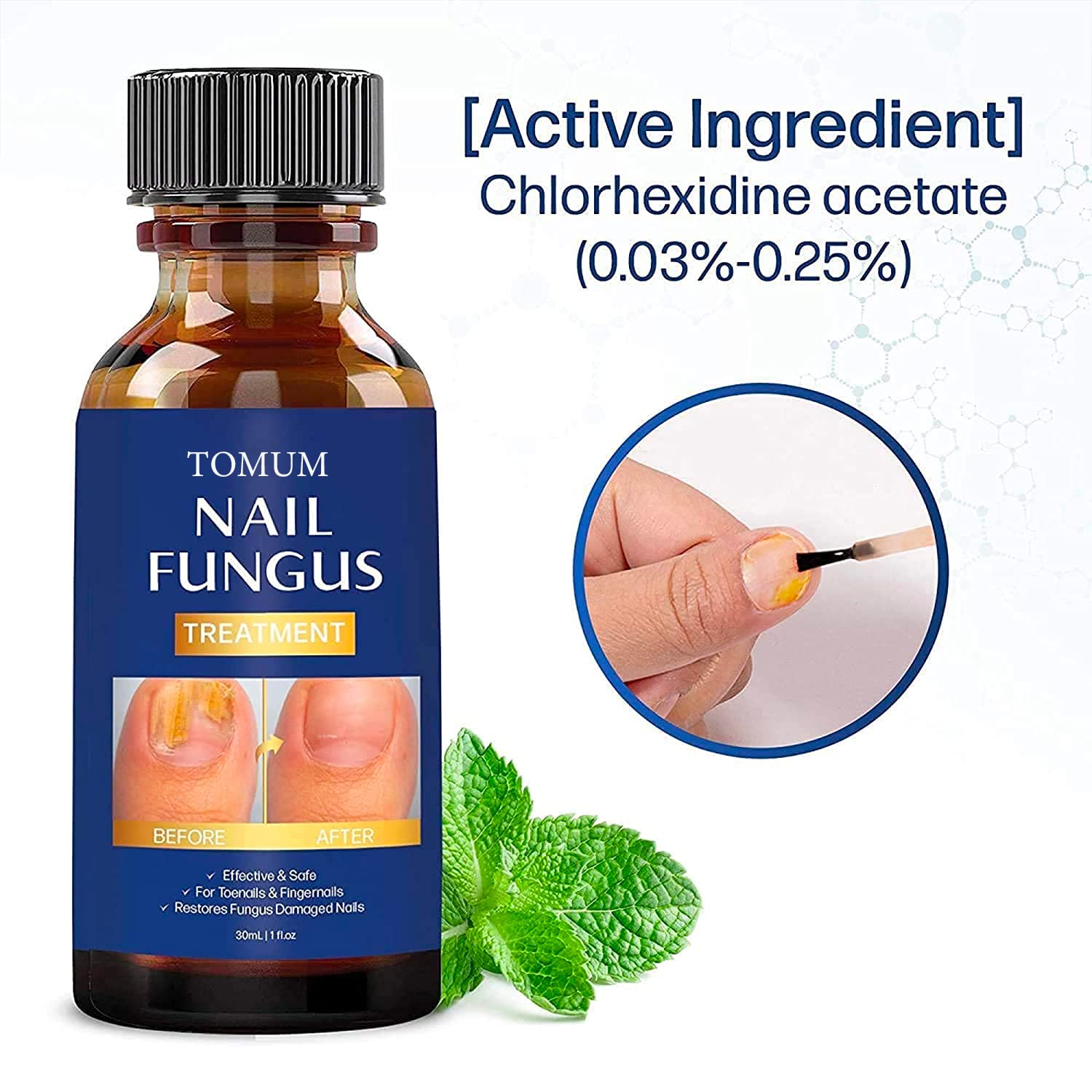 Nail Fungus Treatment for Toenail, Extra Strength Effective Fingernail and Toenail Fungus Killer,Nail Repair Solution, Restoring Healthy Nails
