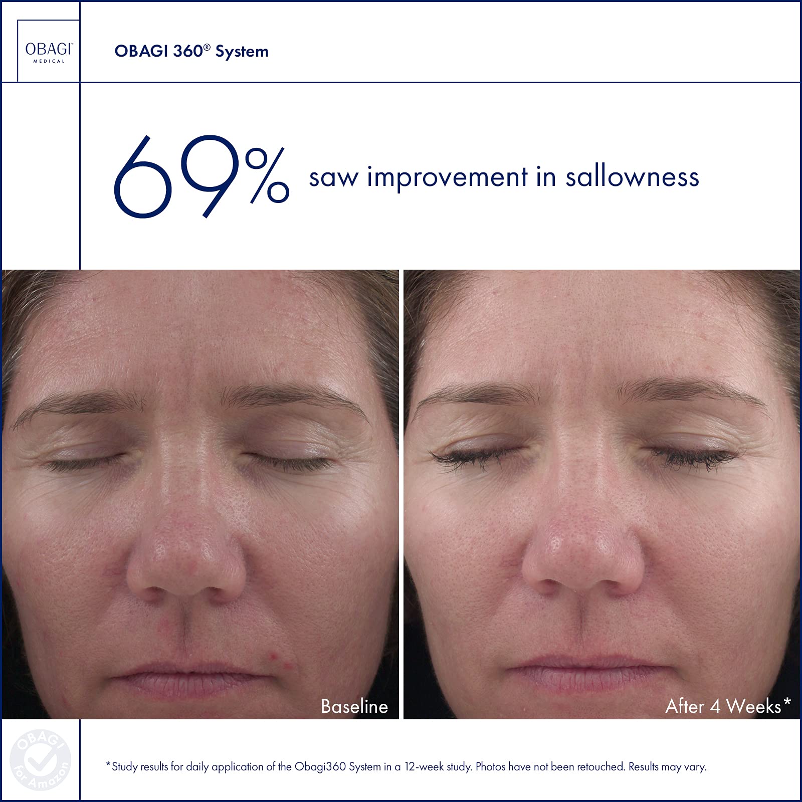Obagi Medical 360 System, 3 Piece Kit. Includes: Exfoliating Face Cleanser, HydraFactor Broad Spectrum SPF 30 Sunscreen, Retinol Moisturizer Cream for Face. Pack of 1