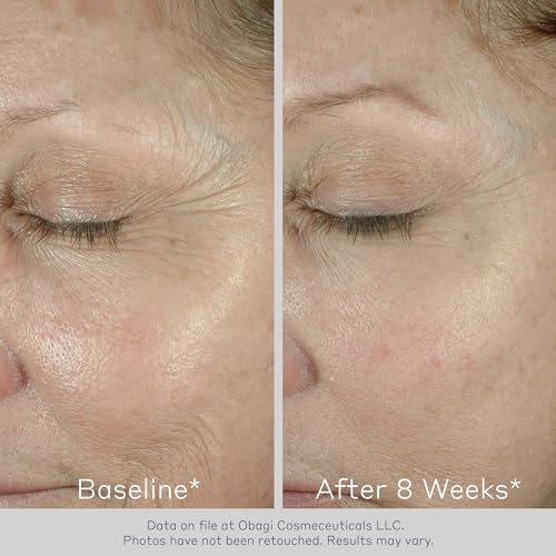 Obagi ELASTIderm Eye Cream β Lightweight Eye Cream Clinically Proven to Reduce the Appearance of Fine Lines & Wrinkles β 0.5 oz