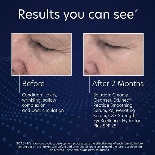 PCA SKIN ExLinea Peptide Smoothing Face Serum, Spot Treatment for Face Serum, Firms Aging Skin, 1.0 fl oz Pump