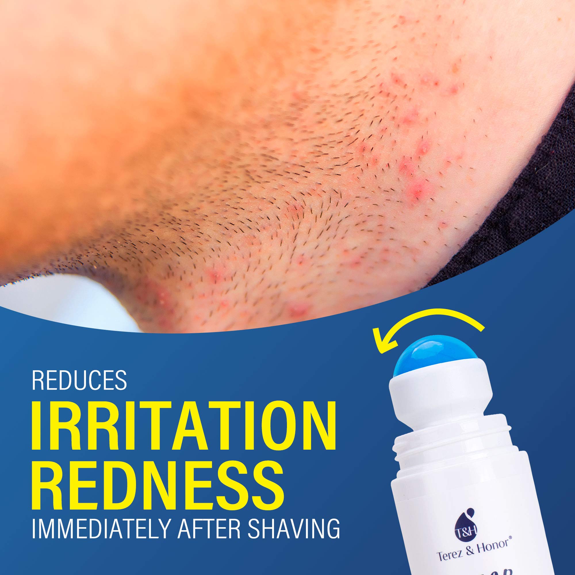 Razor Bump and Ingrown Hairs Serum - After Shave Solution Roll-On for Ingrown Hairs, Razor Burns and Razor Bumps for Men and Women (100g)