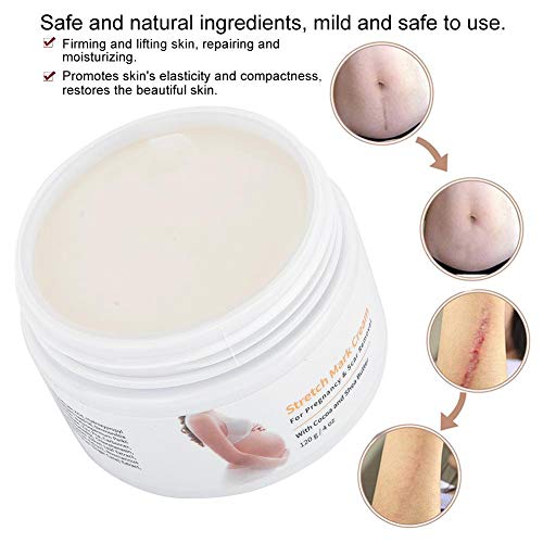 Stretch Mark Cream, Postpartum Obesity Cream, Remove Stretch Marks, Repair Scar Slack Line Abdomen Stretch Marks Postpartum 120g