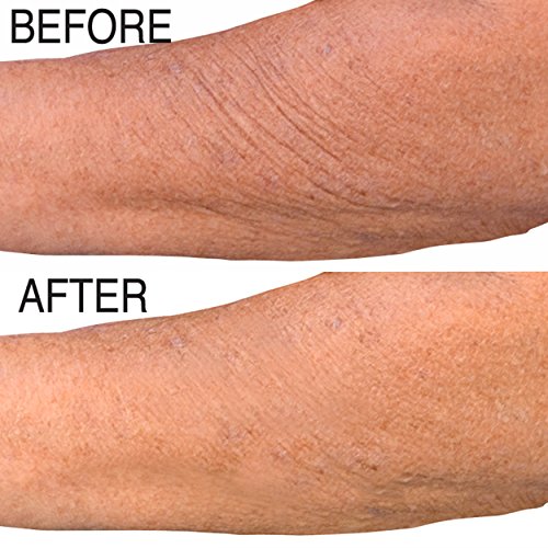 PH Factor 5.5 Clinical Retinol Moisture Cream, Anti-Aging & Skin Firming, 16 Fl Oz w/ Pump, For Face, Body & Hands, Made in USA
