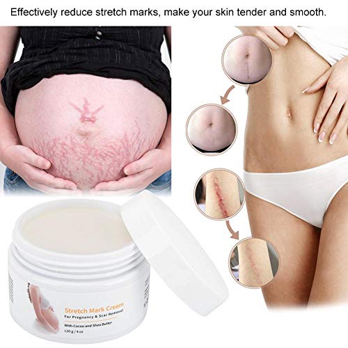 Stretch Mark Cream, Postpartum Obesity Cream, Remove Stretch Marks, Repair Scar Slack Line Abdomen Stretch Marks Postpartum 120g