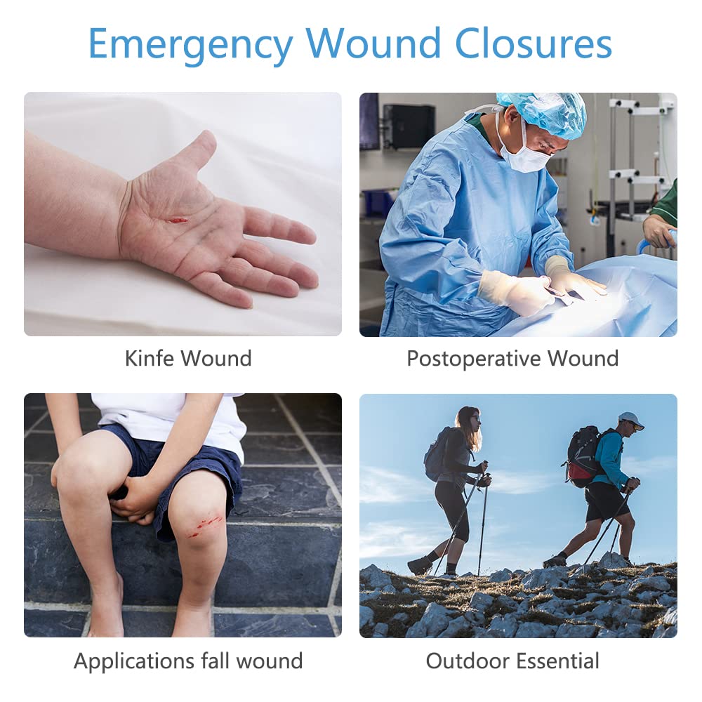 Zip Stitch Wound Closure Kit, Butterfly Bandages, Surgical Quality, Quick Clot for Easy Use, Emergency Laceration Closures, Suture-Free Surgical Repairment, First Aid Wound Care (Yellow, 2)