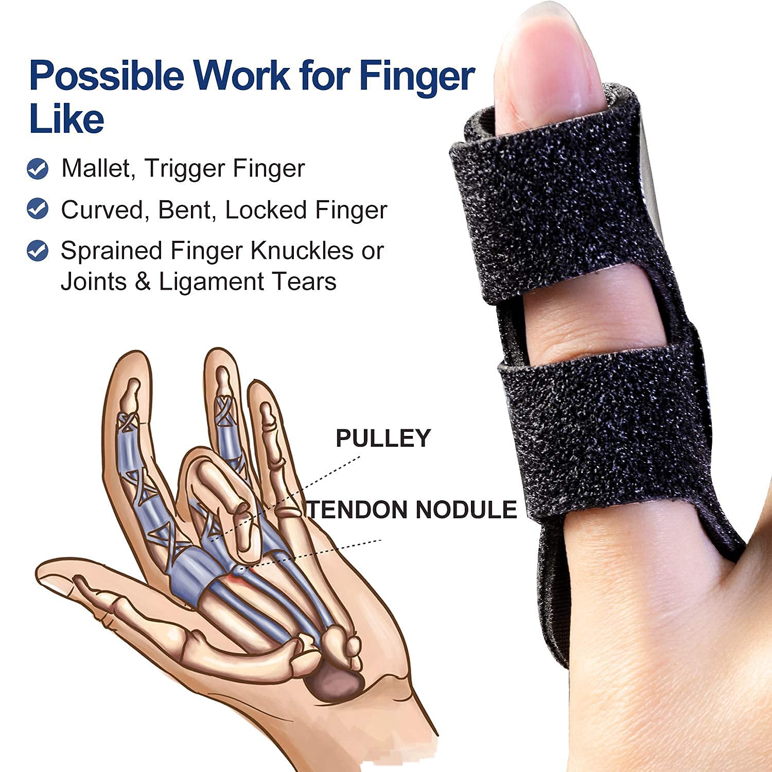 Yzhmjl 6PCS Trigger Finger Splints, Trigger Finger Brace Finger Straightener Finger Support, Finger Splint for All Fingers