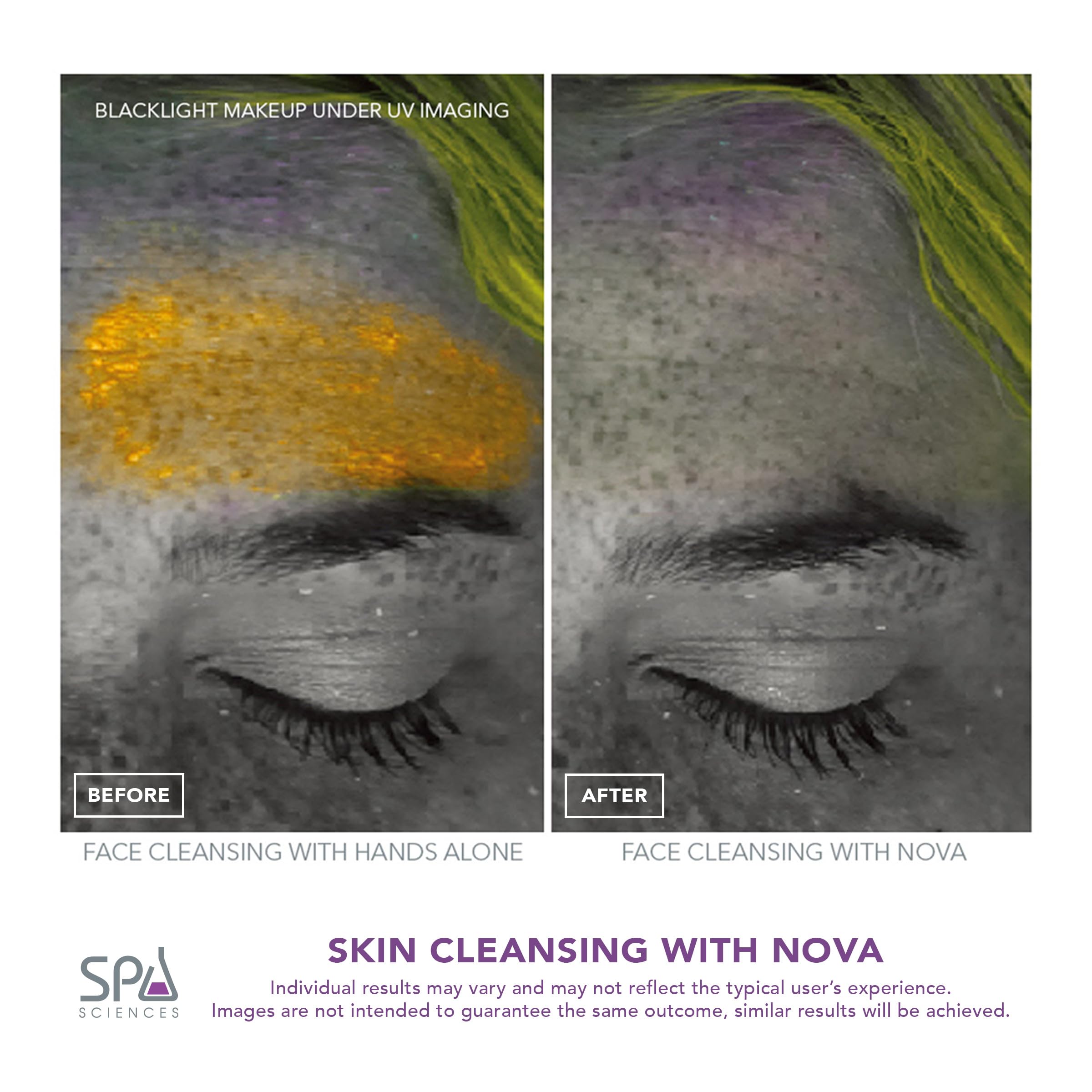 Spa Sciences - NOVA - Sonic Cleansing Brush with Bristles & Infusion System β Anti-Aging Facial Exfoliating, Waterproof, and USB Rechargeable