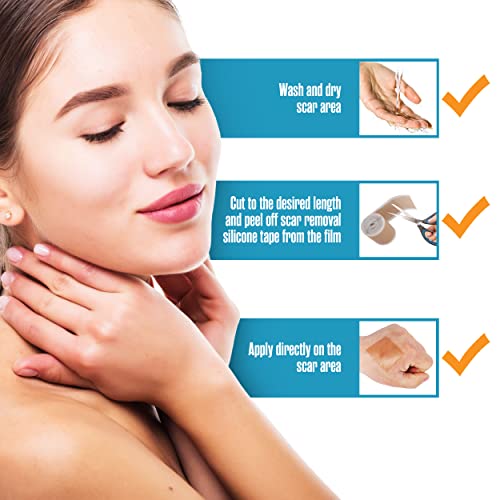 Silicone Scar Sheets, Soft Gel Tape, 1.57β x 60β, with 2β Perforations, Tan, Flexible, Medical Grade for Surgery, Keloids, Burns, Sensitive Skin, Wound Protection, Healing Patch | Houseables