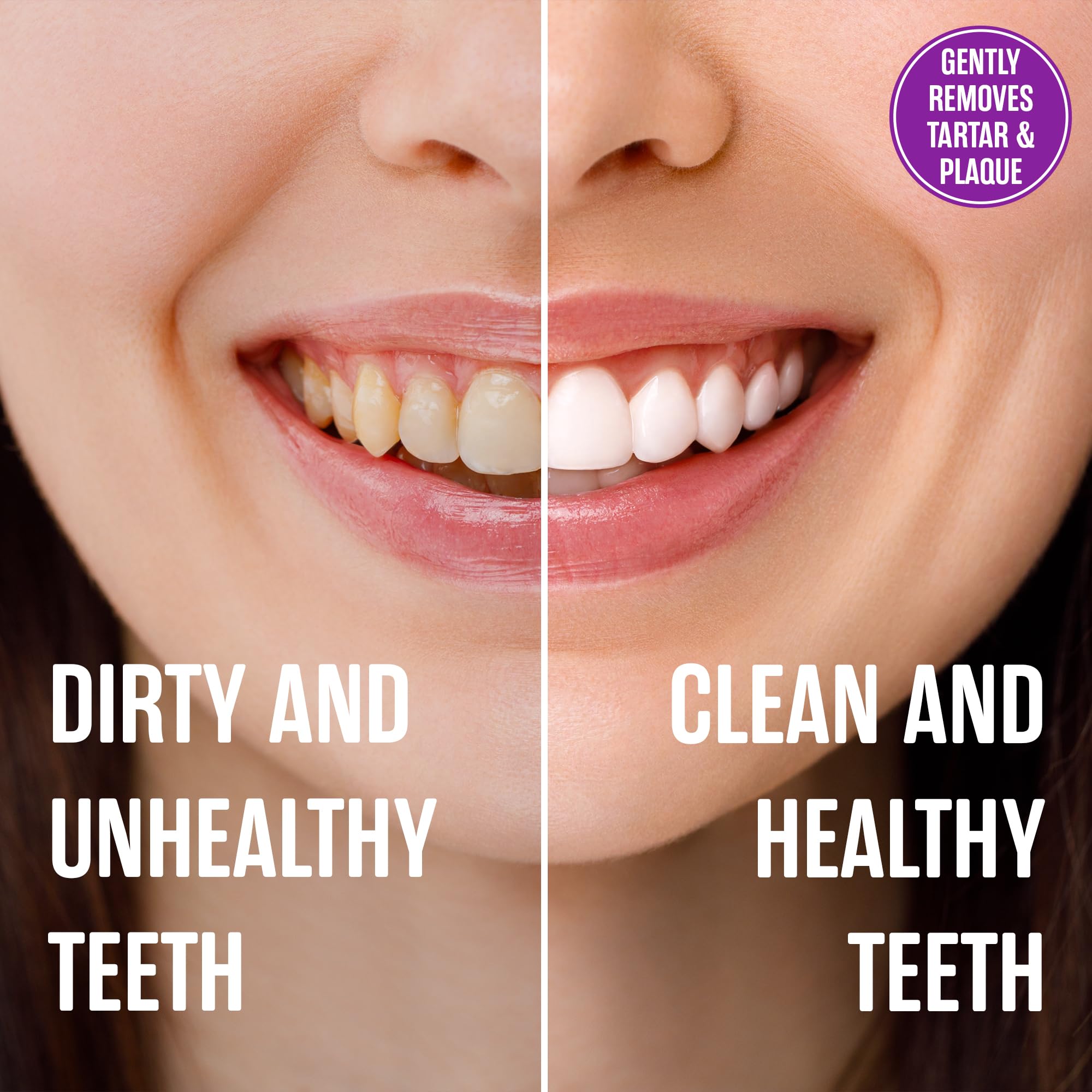 SprinJene Patented Toothpaste Sensitive Teeth & Gum w/Fluoride Cavity Protection Non Toxic SLS Free Fresh Breath Dry Mouth,Preservative Free, 2 Pack