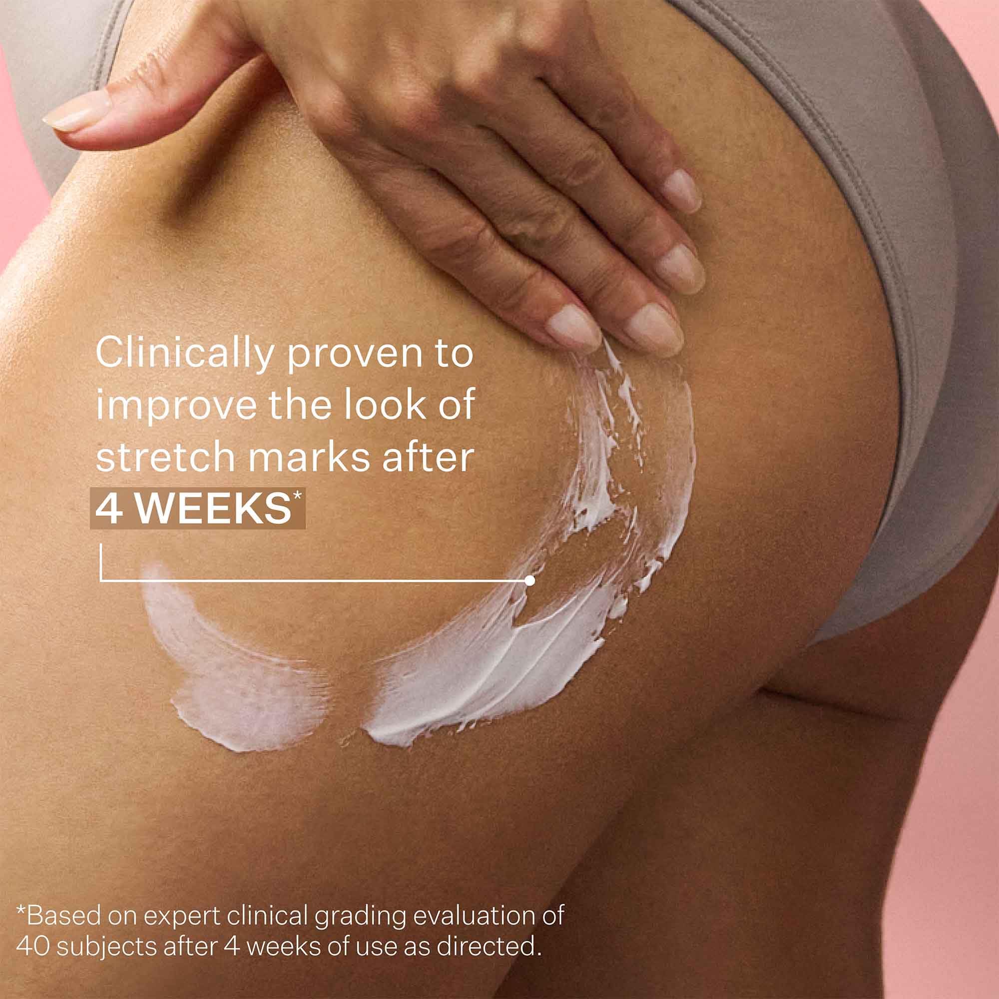 StriVectin Anti-Wrinkle SD Advanced PLUS Intensive Moisturizing Concentrate for Wrinkles and Stretch Marks with Collagen-Targeting Technology, 4 Fl Oz