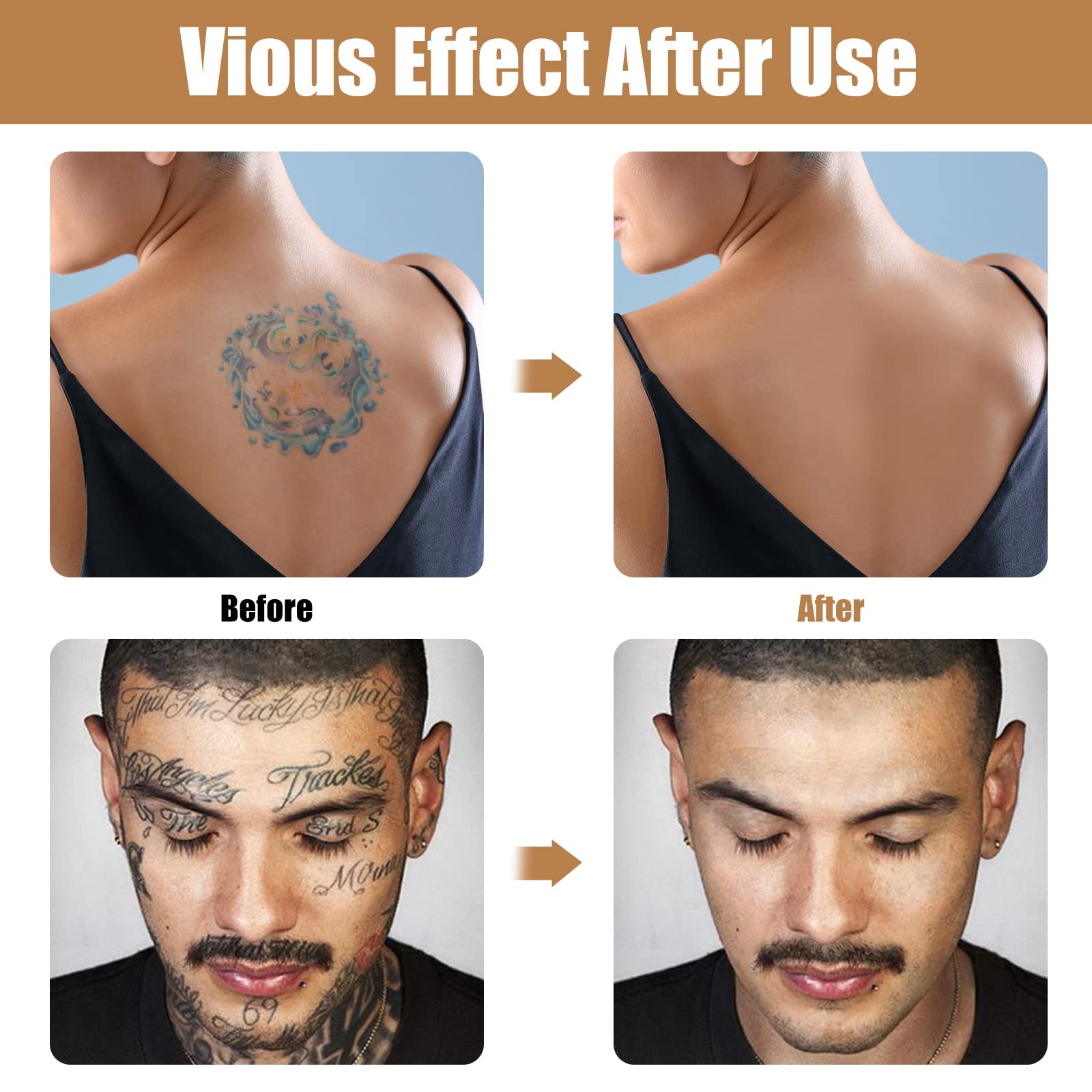 Tattoo Cover Up, Tattoo Concealer for Dark Spots, Scars, Vitiligo, and More, a Set of 2 Colors, Long Lasting & Waterproof