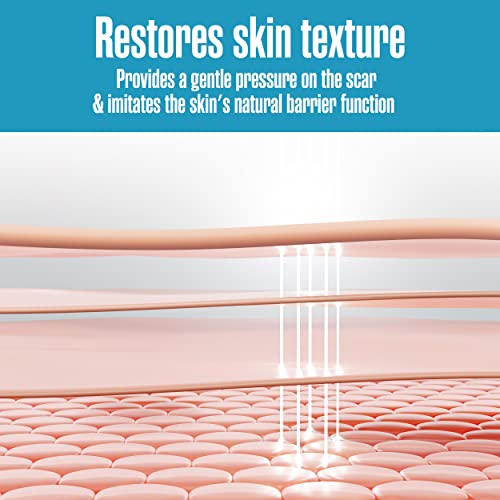 Silicone Scar Sheets, Soft Gel Tape, 1.57β x 60β, with 2β Perforations, Tan, Flexible, Medical Grade for Surgery, Keloids, Burns, Sensitive Skin, Wound Protection, Healing Patch | Houseables