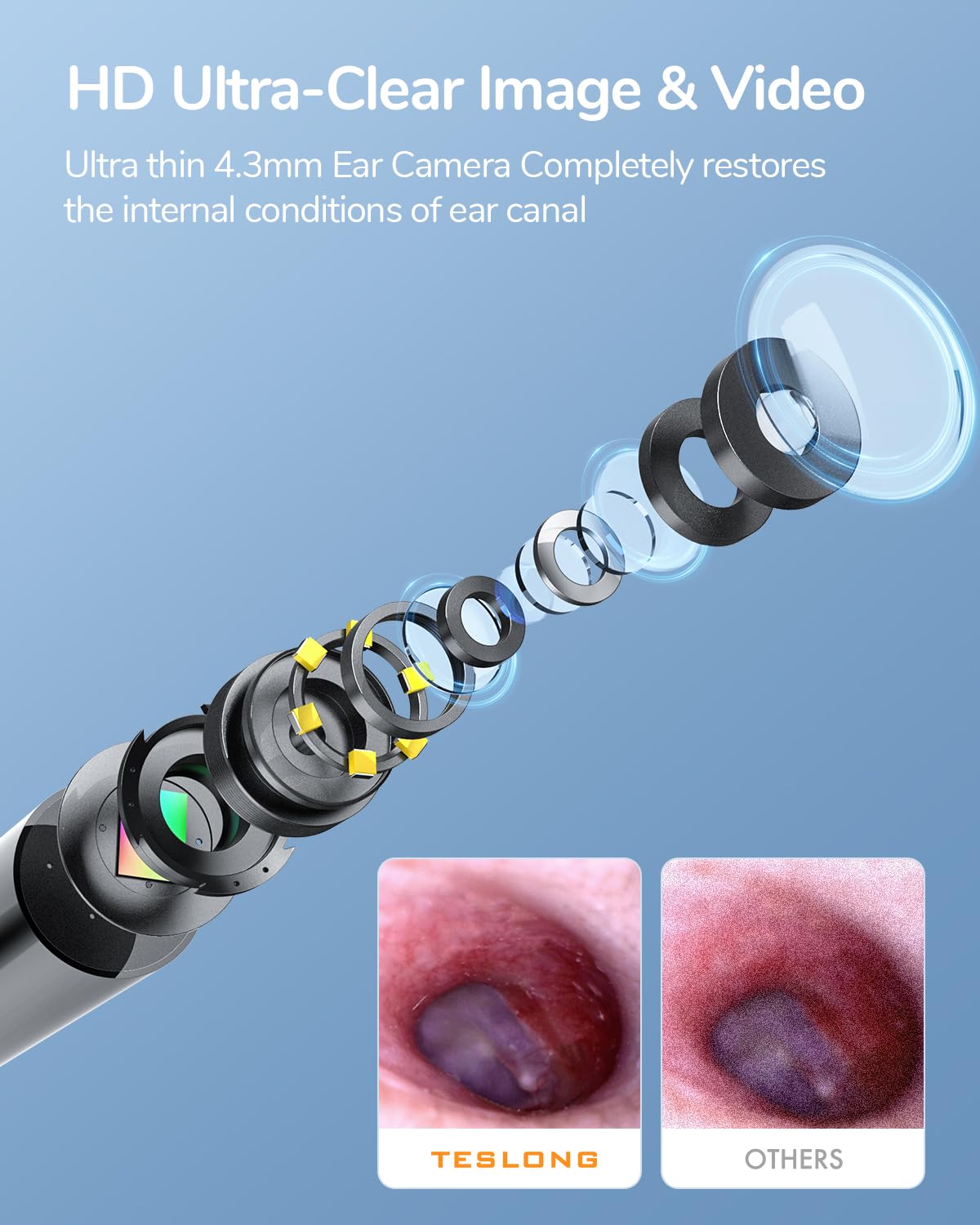 Teslong Otoscope, Video Otoscope with Light, Digital Otoscope with Ear Wax Removal Tools, Ear Camera for Android Phone, USB, with Ear Picks