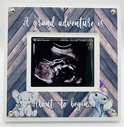 Ultrasound Photo Frame with 6 Front and Back Pregnancy Milestone Cards