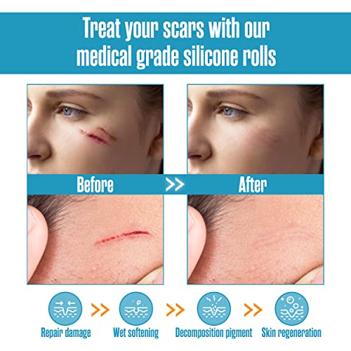 Silicone Scar Sheets, Soft Gel Tape, 1.57β x 60β, with 2β Perforations, Tan, Flexible, Medical Grade for Surgery, Keloids, Burns, Sensitive Skin, Wound Protection, Healing Patch | Houseables