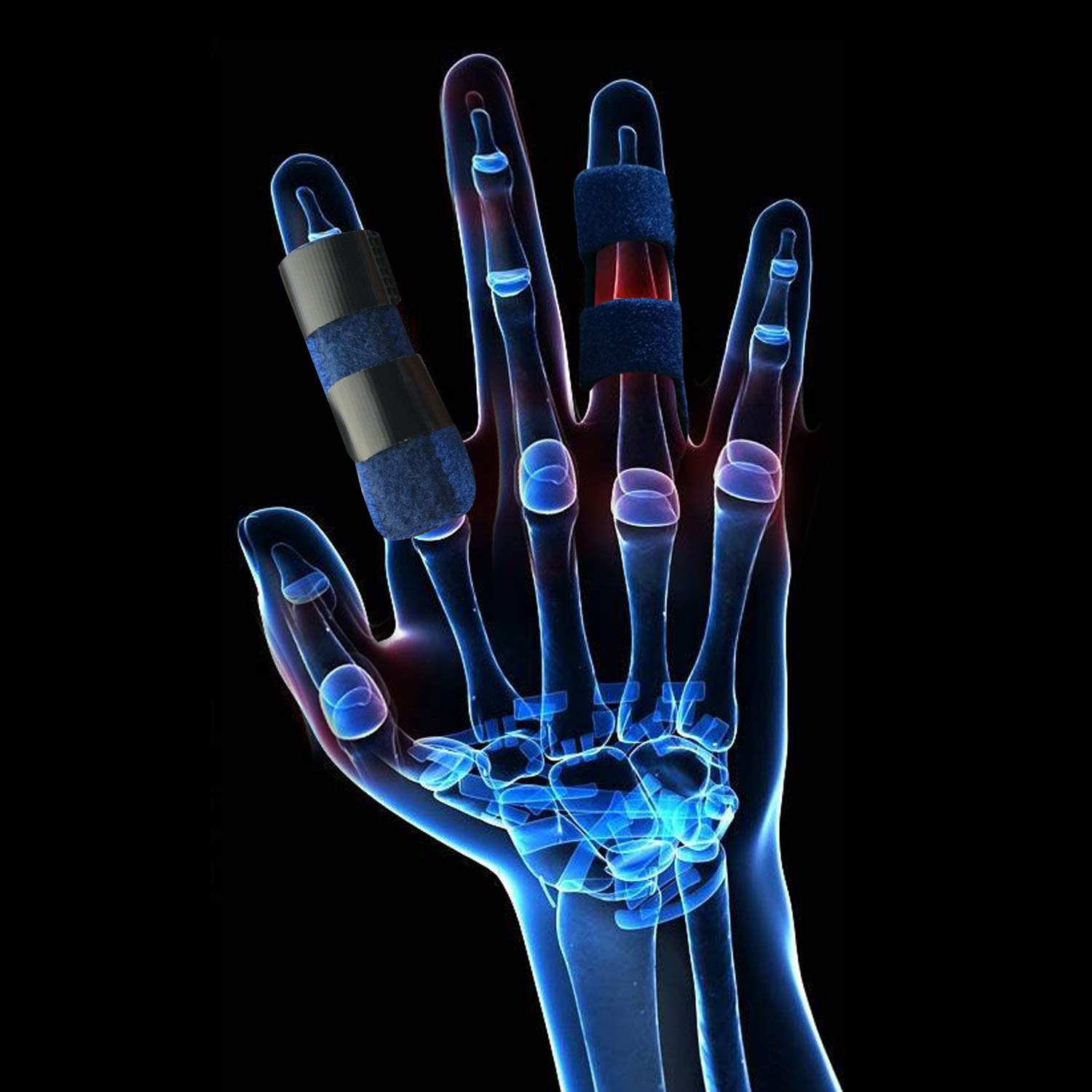 SUHINFE Trigger Finger Splints (2 Sets), Lightweight Sport Finger Sleeves and Finger Brace for Mallet Finger, Middle Finger, Pinky Finger, Arthritis, Broken Finger