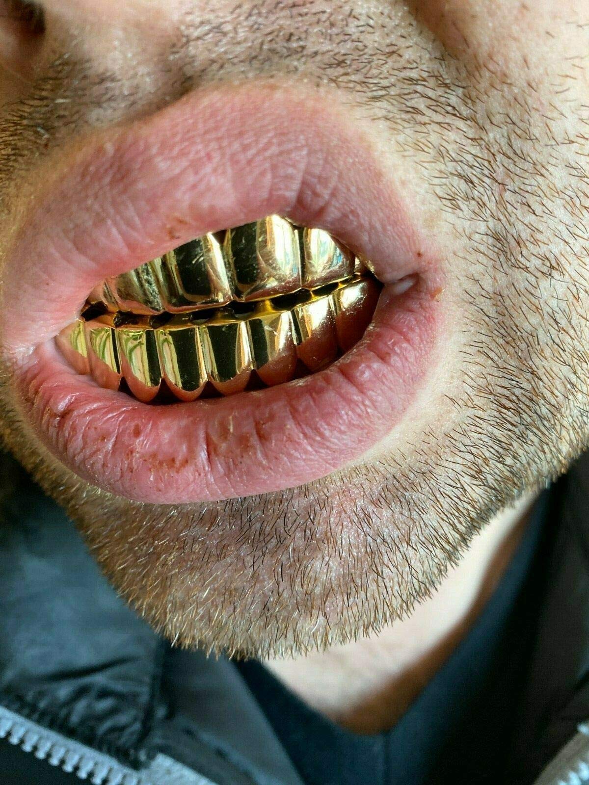 Solid 925 Sterling Silver Real Grillz - 14k Gold Plated - Custom Top & Bottom Grills For Teeth - Real Solid Silver NOT BRASS