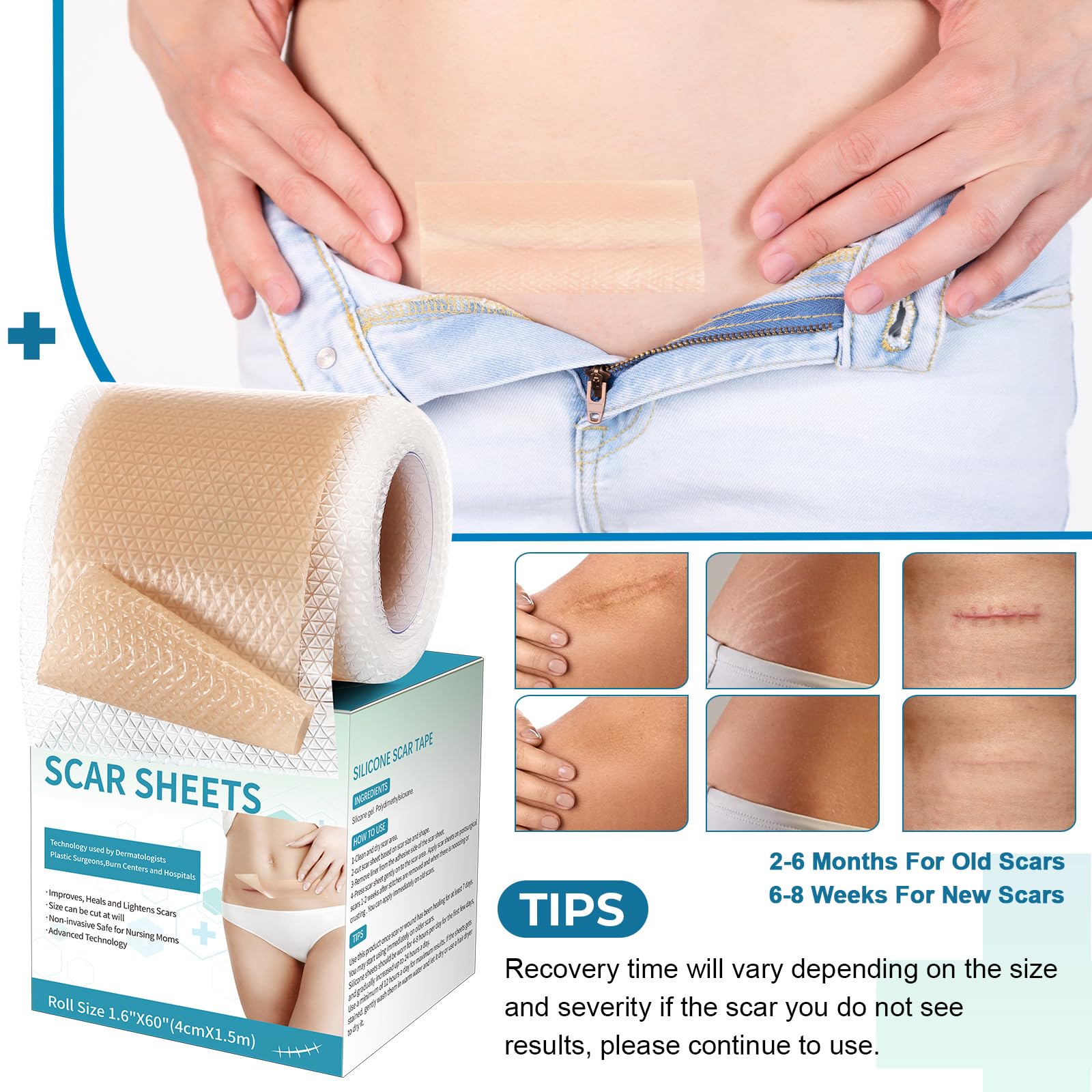 Silicone Scar Sheets, Silicone Scar Tape(1.6βx 60β Roll-1.5M), Silicone Scar Strips, Professional Scar Removal Sheets for Surgical Scars, Keloid, C-Section, Burn et