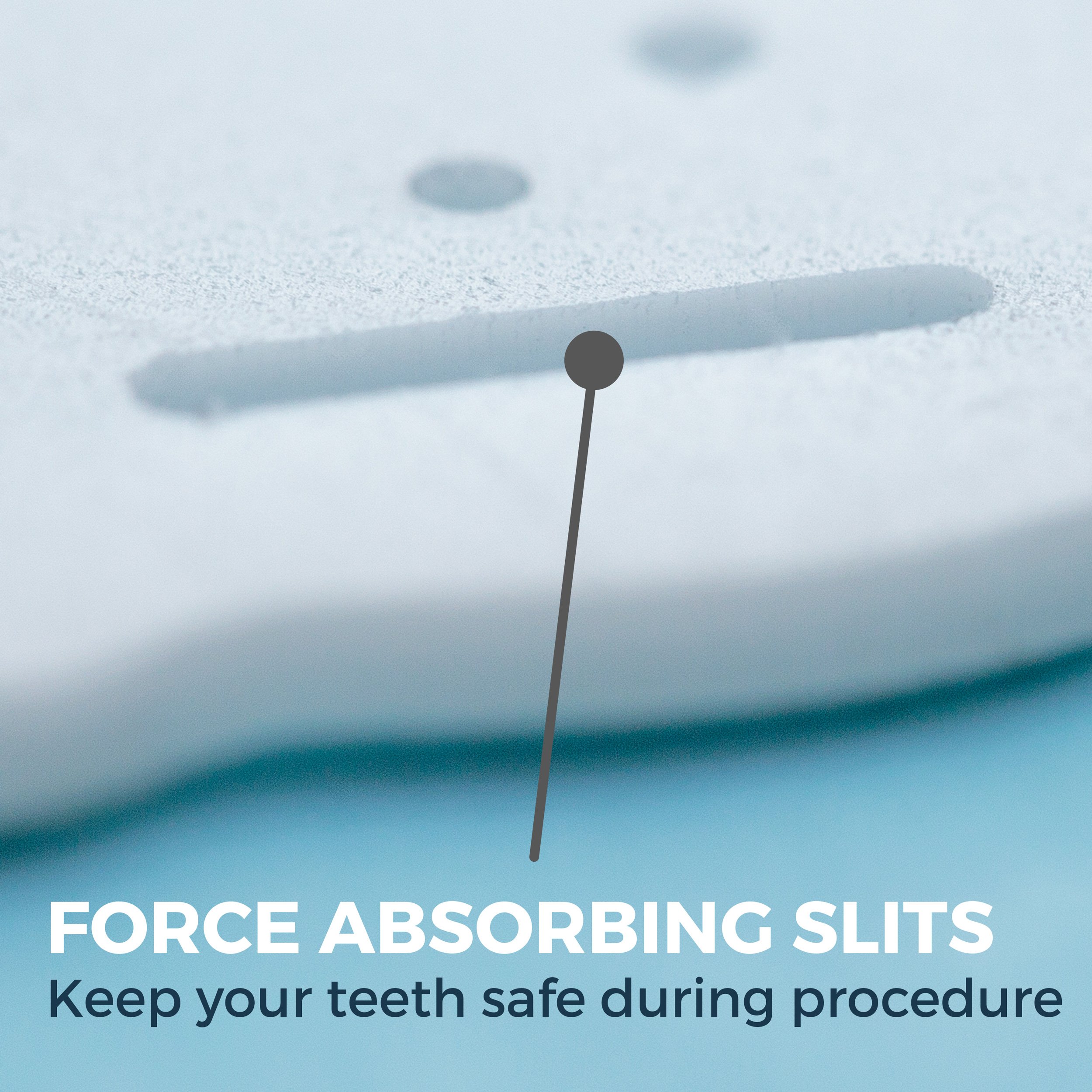 SISU Intuguard Custom Fit Intubation Mouth Guard for Dental Protection During Surgical Procedures
