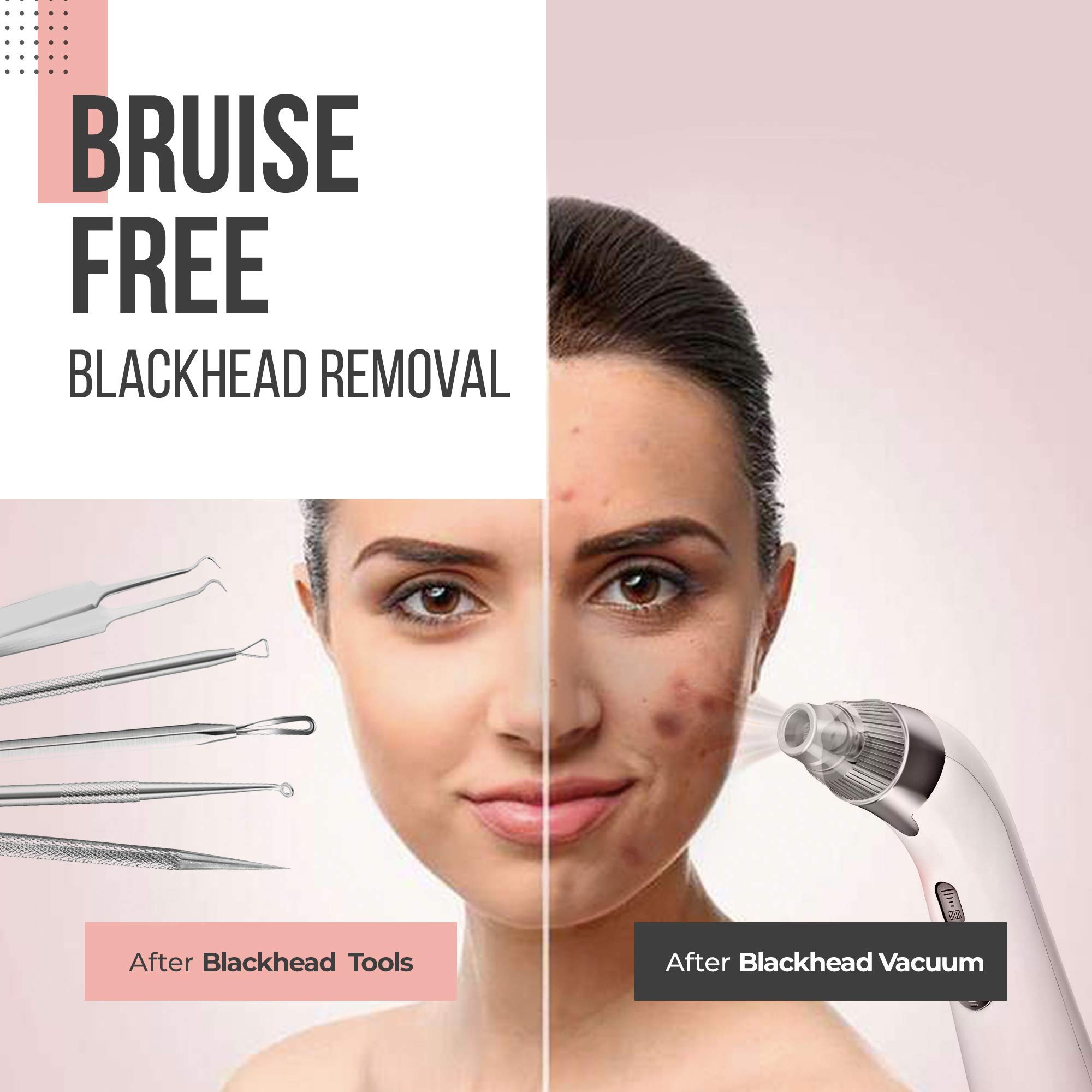 The Good Stuff Black Head Removal Tools with Mirrored Travel Case, 5 pcs Kit, Black