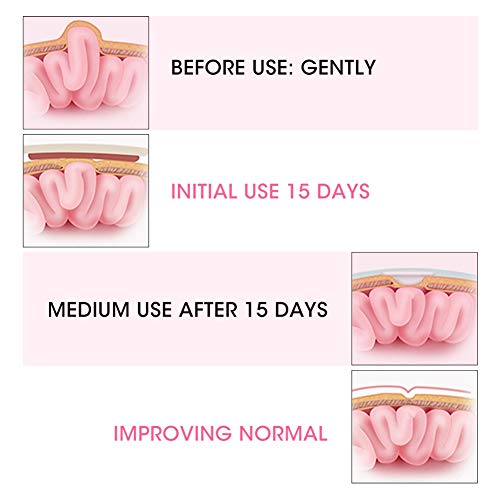 ZJchao Hernia Belt for Babies, 2-piece Hernia Belt Treatment For Hernia Therapy For Children Umbilical Hernia Belt for Newborns Infant Newborn Belt(Rosa)