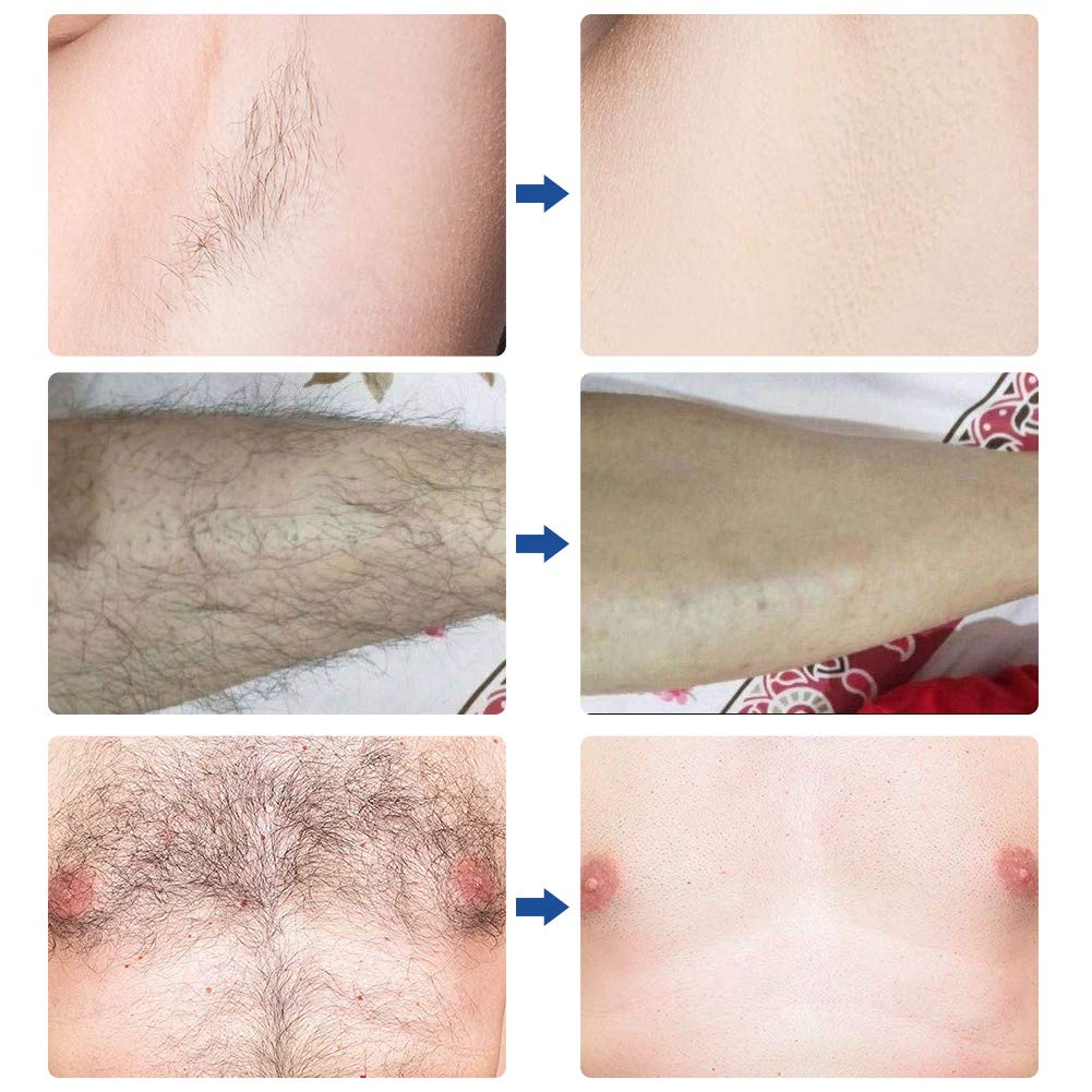 Wax Strips, Hair Removal Waxing Strips, Facial Wax Strips, Body Wax Strips (40PC)