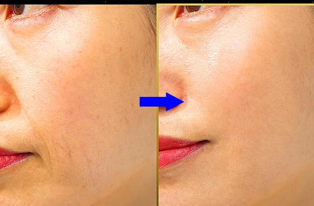 WHITESILK―(𝟐𝟎𝟐𝟒 𝐔𝐩𝐠𝐫𝐚𝐝𝐞𝐝) [(0.03%) Retinaldehyde +(1%) Bakuchiol] INSTANT Wrinkle Smoothing & Line Filler Cream (30ml/1oz)